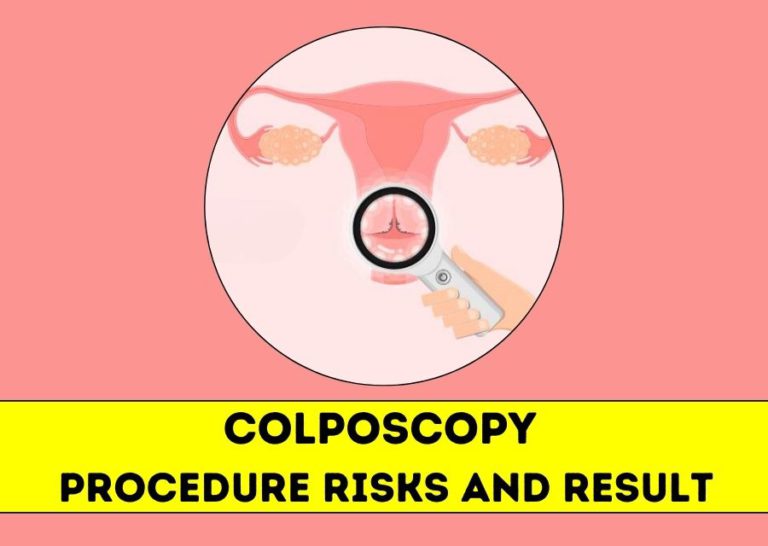 Colposcopy Procedure Risks and Result - padalkarhospital
